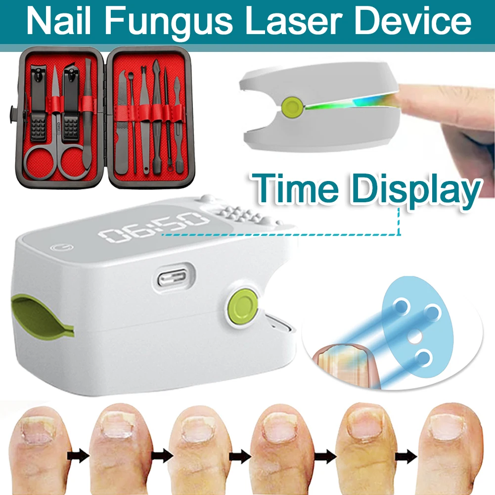 Nail-Fungus-Laser-Cure-Machine-Nail-Treatments-Device-Foot-Care-Nail ...