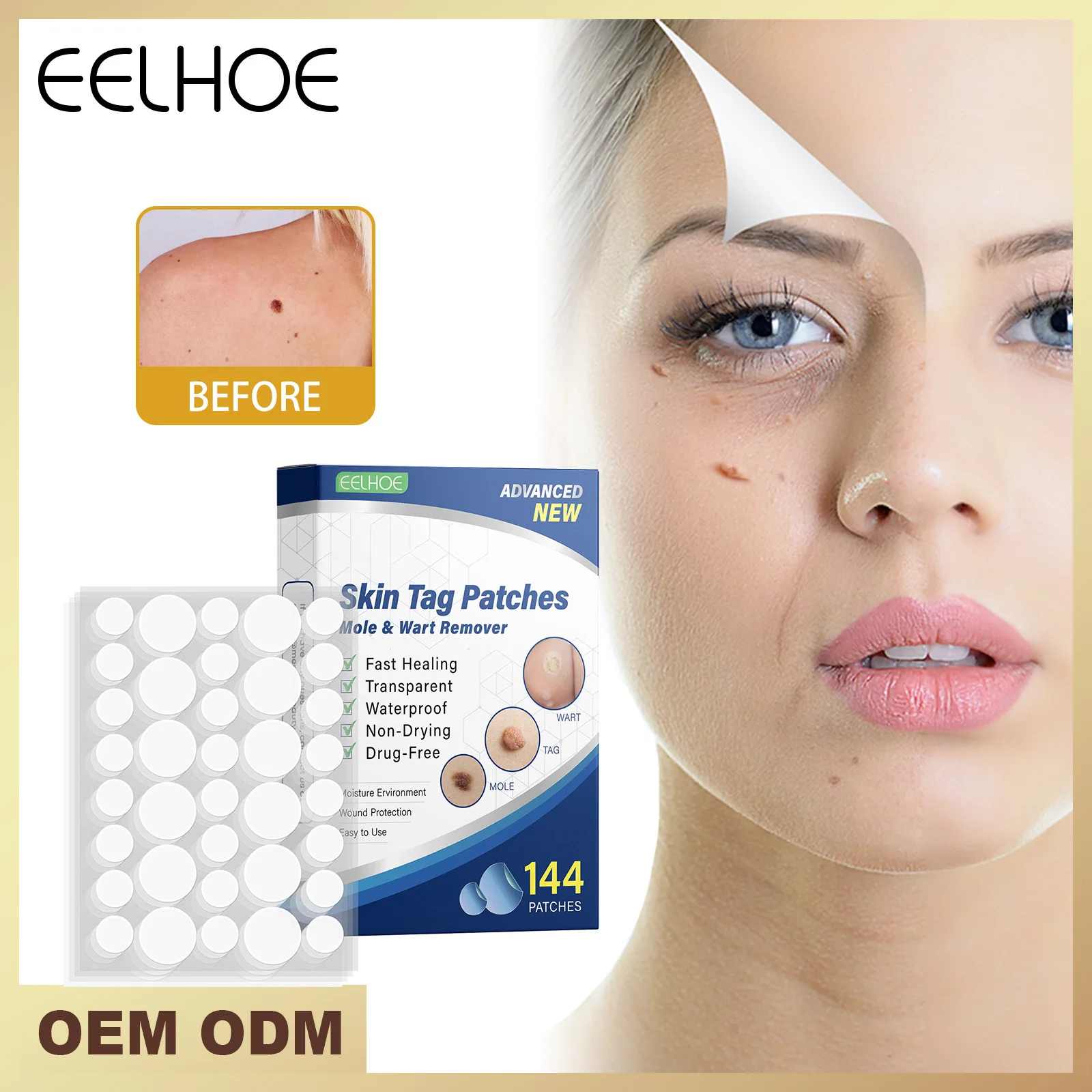 Eelhoe Skin Tag Patch Wart Remover Nevus Mole Cleaning Care Removal ...