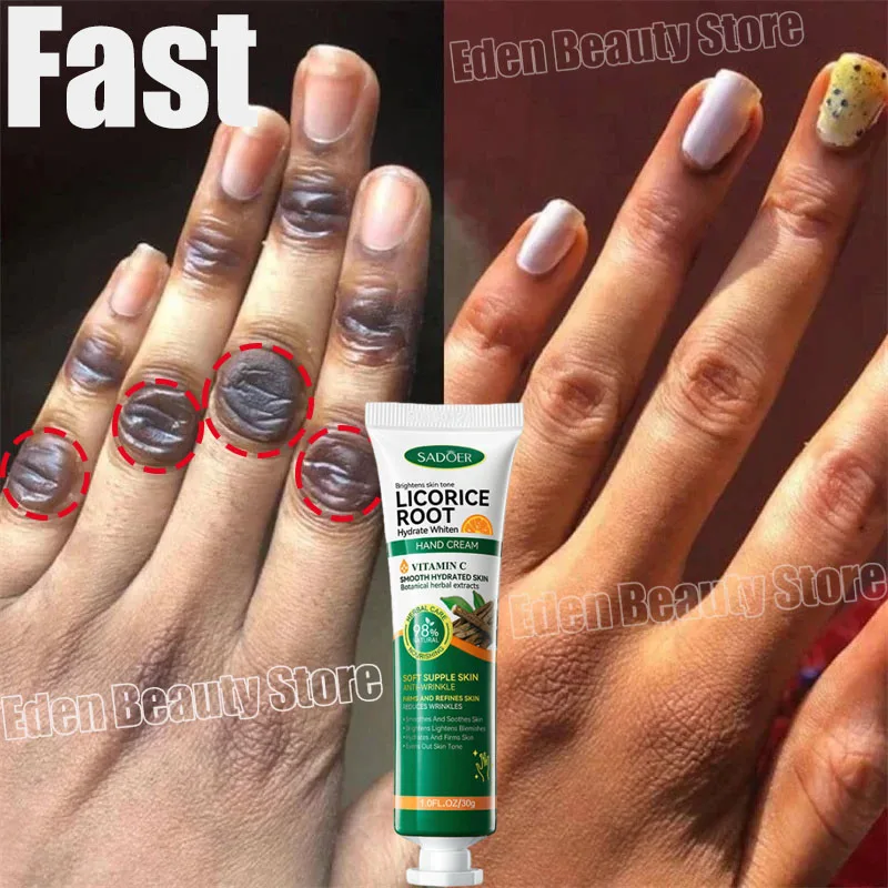 Fast-Whitening-Dark-Knuckles-Brighten-Hand-Cream-Melanin-Corrector ...
