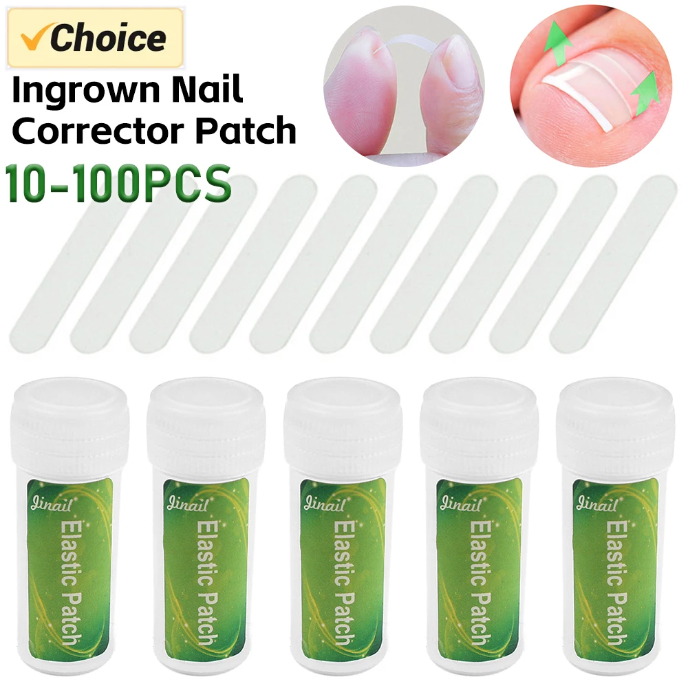 10-100PCS-Ingrown-Toenail-Corrector-Straightening-Clip-Pedicure-Foot ...