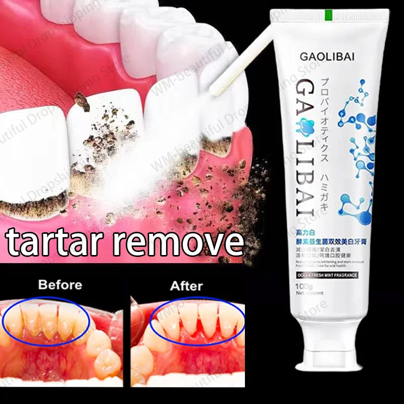 Remove-Yellow-Teeth-Toothpaste-Dental-Calculus-Removal-Mouth-Odour-Bad ...