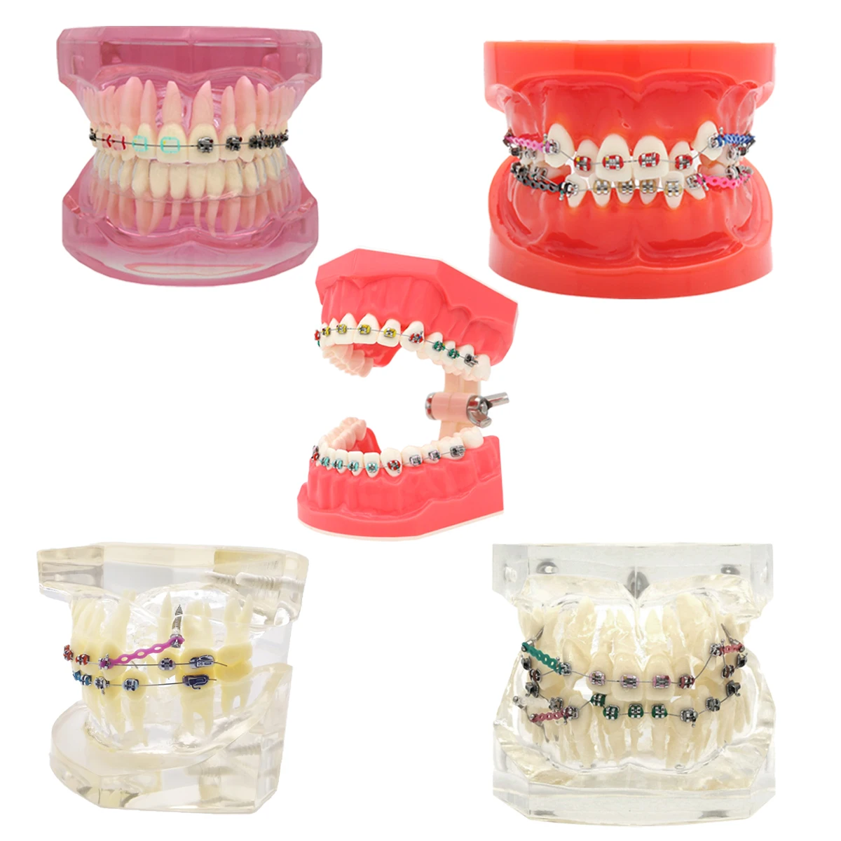 Modello-dentale-con-bretelle-ortodonzia-modellazione-di-denti-finti-per ...