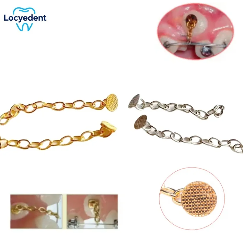 4pcs/Pack Dental Orthodontics Lingual Traction Button Chain Golden ...