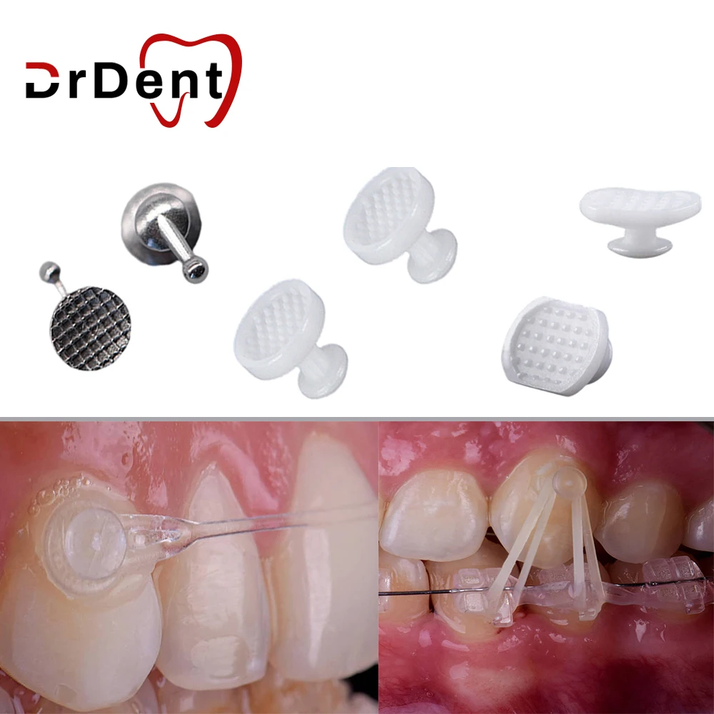 Drdent-bot-n-Lingual-de-ortodoncia-compuesto-de-ojal-de-uni-n-cer-mica ...