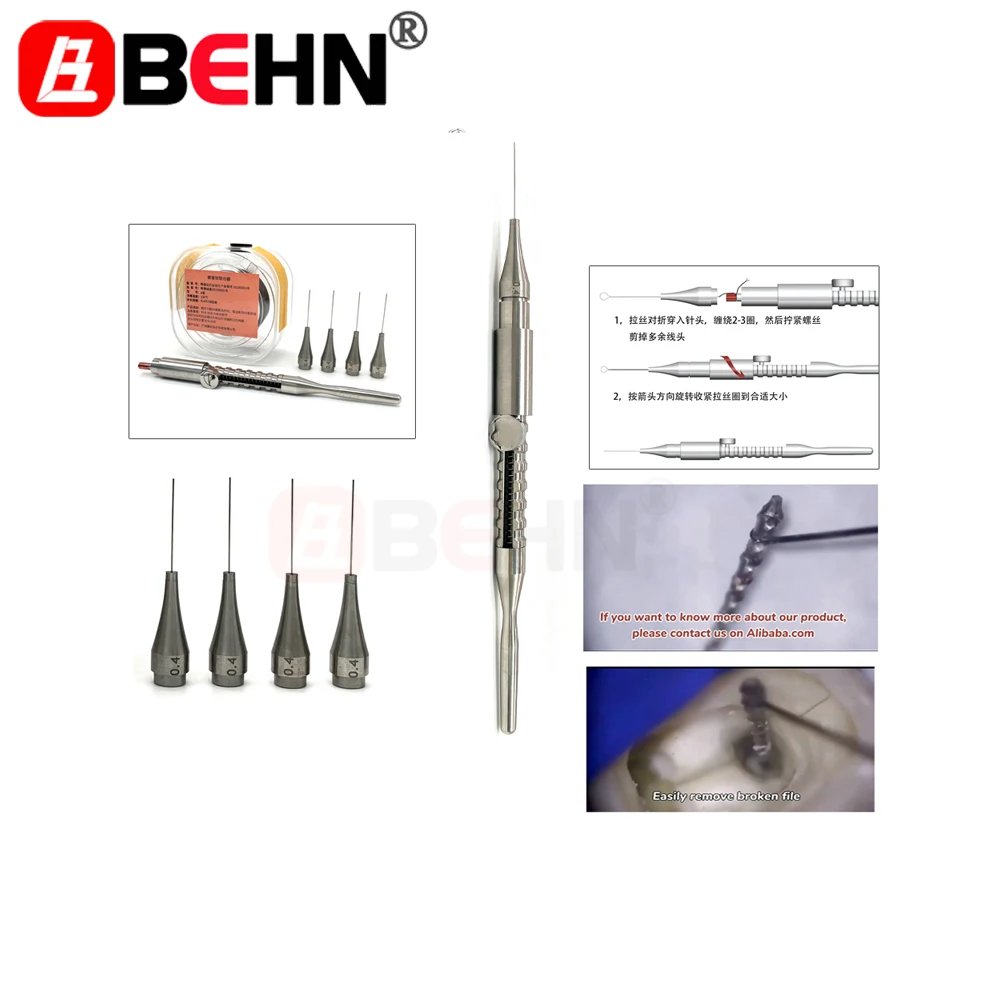 Dental-Broken-Root-Canal-Pen-Remover-Dentistry-Endo-Restoration ...