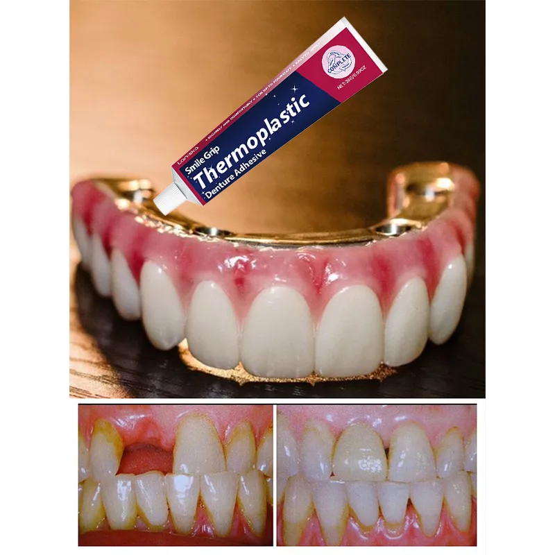 Comfort Denture Adhesives Glue Teeth Care Thermoplastic Denture ...