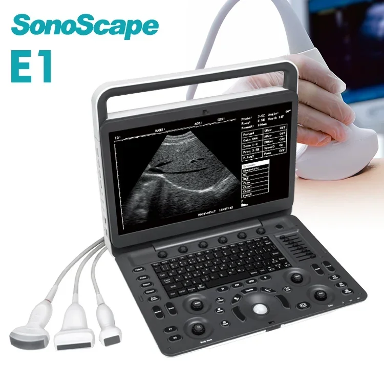 Sonoscape-E1-E2-medical-ultrasound-instruments-4d-ultrasound-machine ...