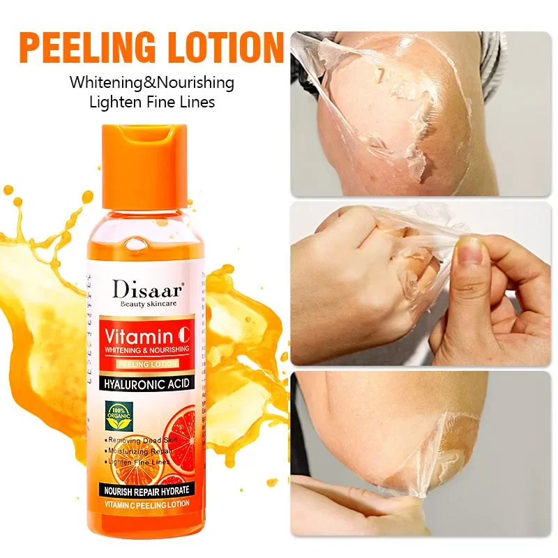 Yellow-Peeling-Lotion-Oil-100-Organic-Bleaching-Dark-Skin-Exfoliating ...