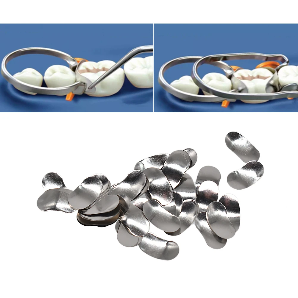 10pcs/bag Dental Sectional Contoured Matrices Matrix Bands S/M/L ...