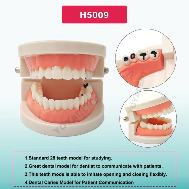 Dental Implant Model Dental Teeth Model – Ortho Implant Practice ...