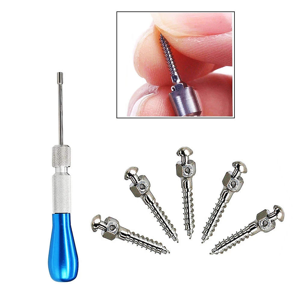 Mini-implantes-dentales-de-ortodoncia-5-piezas-tornillos-de-anclaje ...