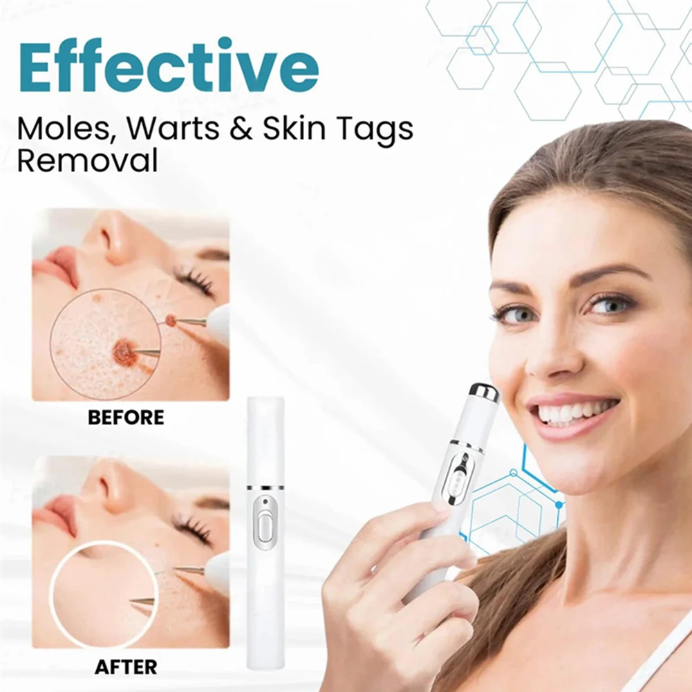 Mole Wart Removal Pen Professional Facial Dark Spot Remover ...