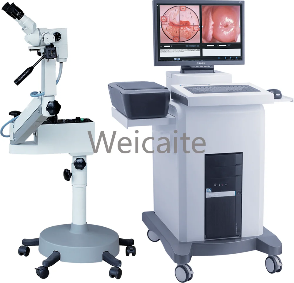 Optical Colposcope for Vagina: A Practical Guide to Digital ...