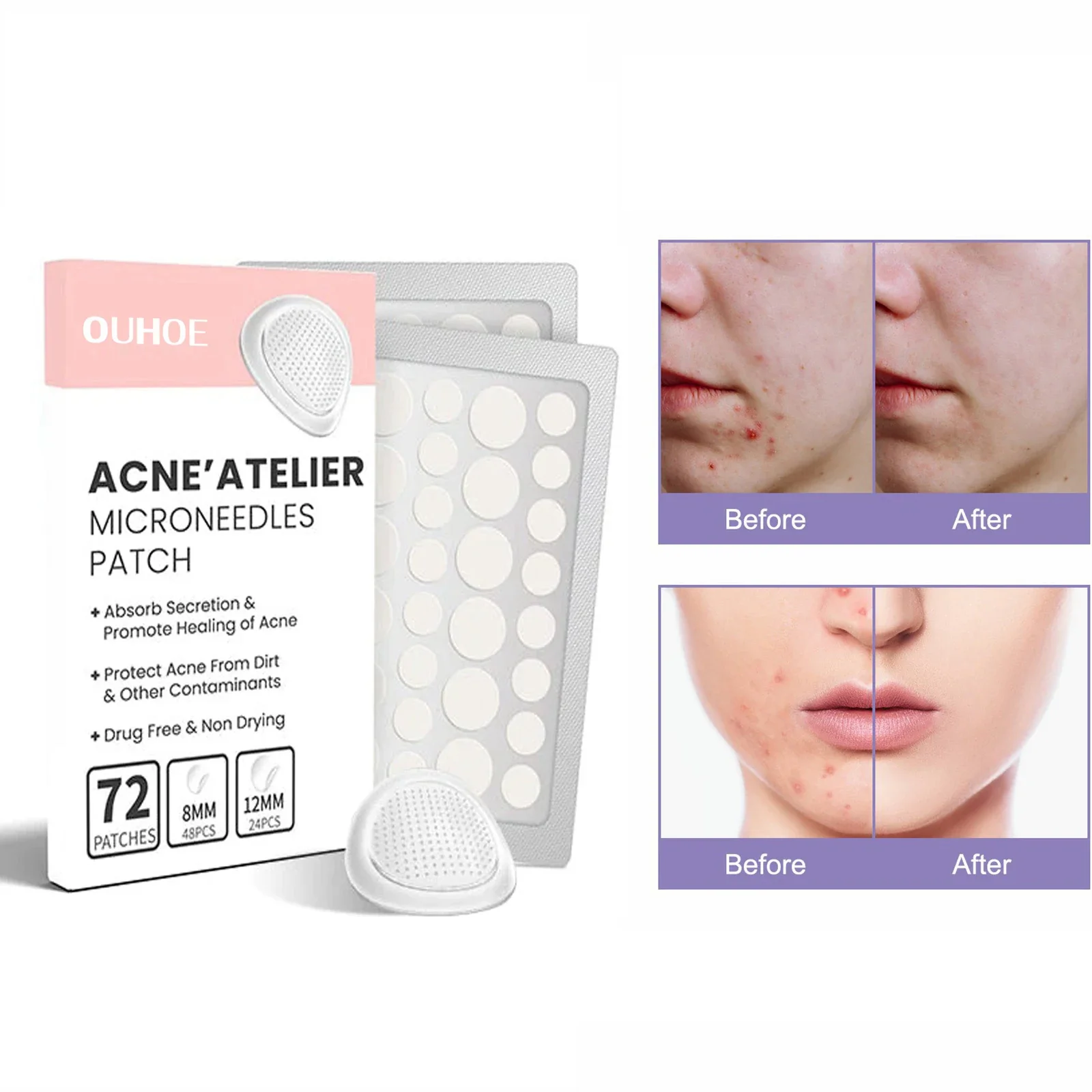 72pcs-Daily-Transparent-Acne-Clean-Patch-Skin-friendly-Elastic-Skin ...