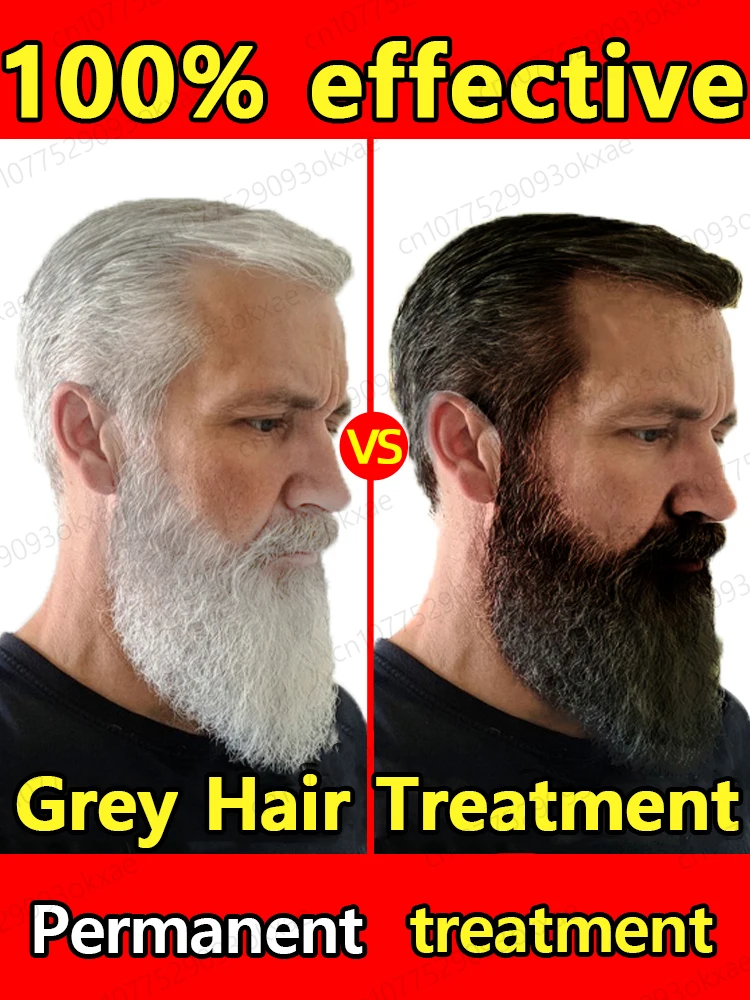 White-hair-treatment-essence-quickly-turns-white-hair-into-black-hair ...