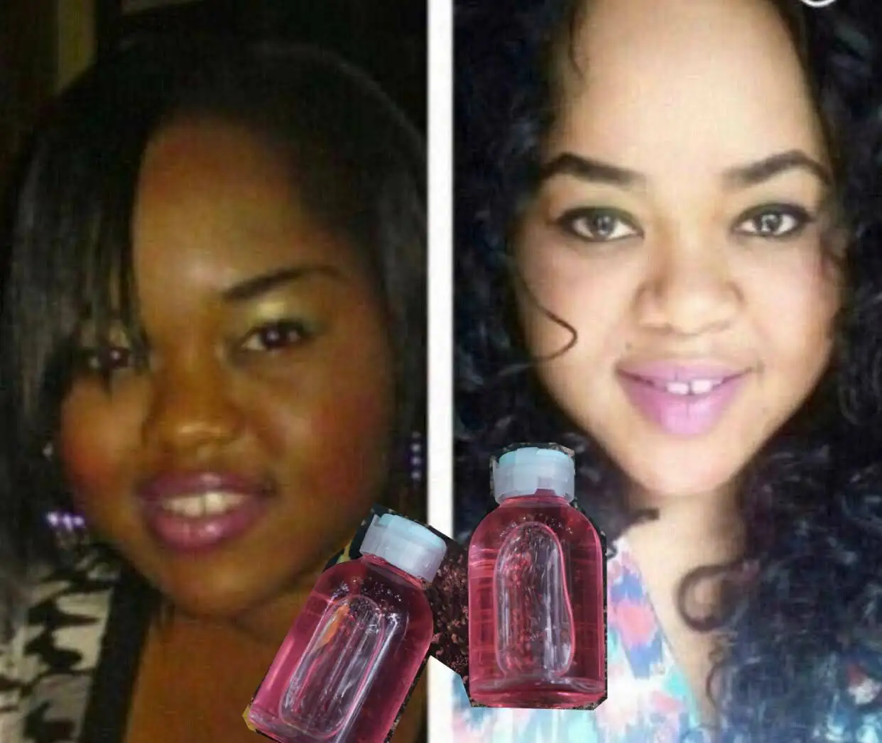 Skin Bleaching Results