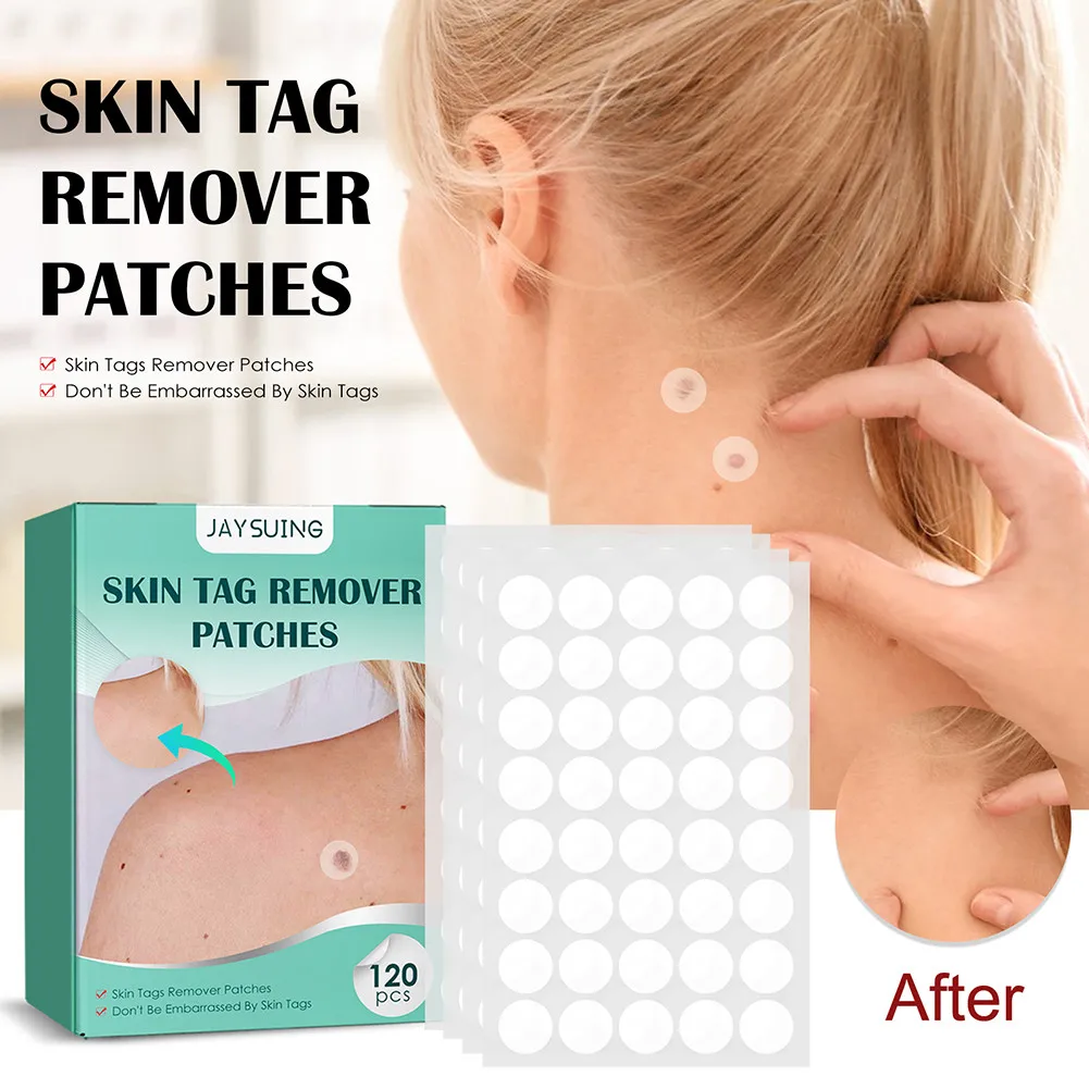 120/240pcs Skin Tag Remover Patch Wart Treatment Stickers Absorb ...