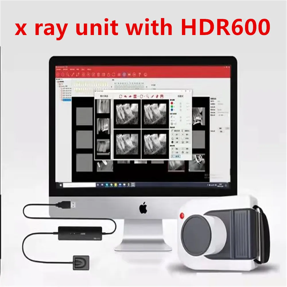 portable-dental-x-ray-machine-and-HDR-500-digital-sensor-rvg-vertical ...