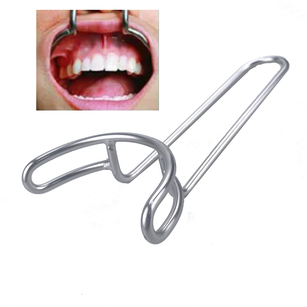 Retractor-de-labios-Intraoral-productos-dentales-alta-calidad.jpg