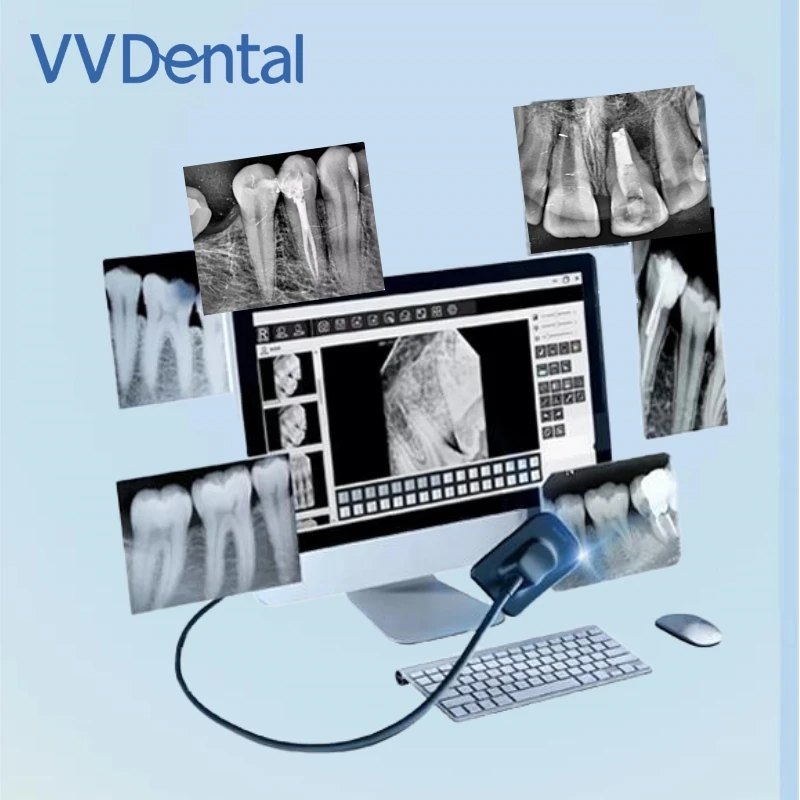 VV-Dental-Sensor-X-Ray-Radiovisiograph-High-Frequency-Digital-Intraoral ...