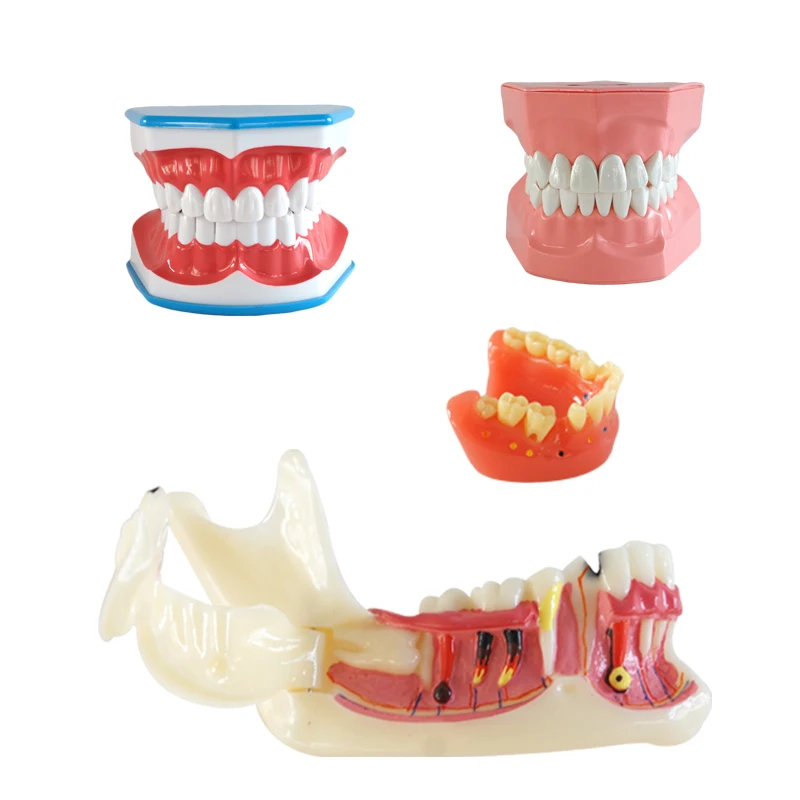 Dental-Teeth-Model-Dental-Teaching-Model-Teeth-Brushing-Model-with ...