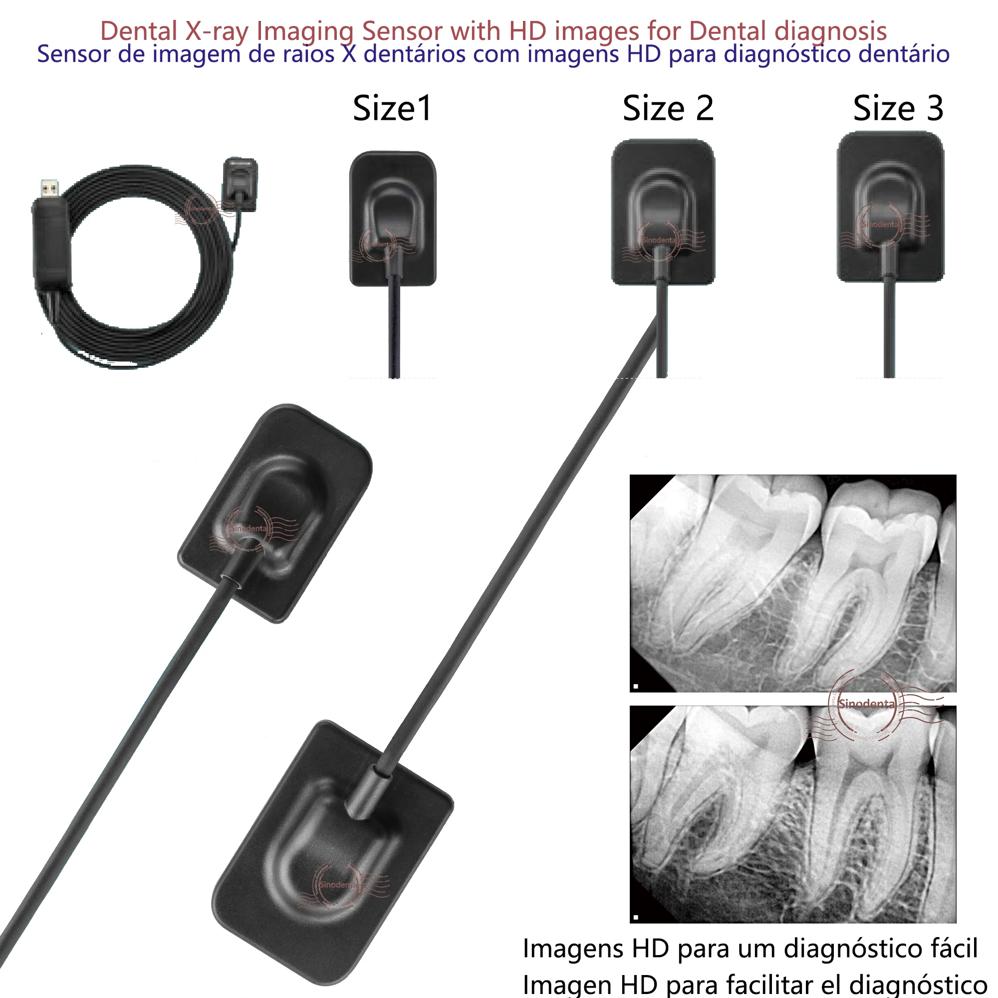 Digital Radiography Sensor for Dental Clinics: What You Need to Know ...