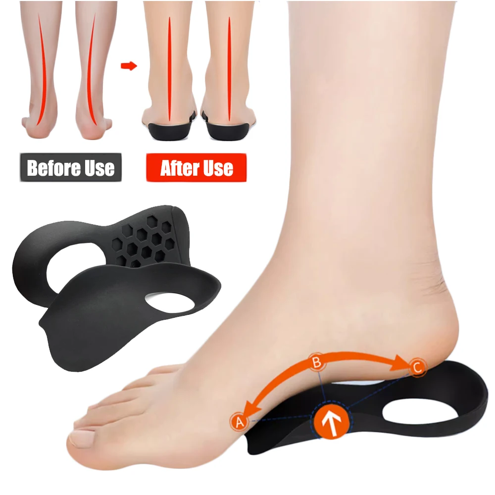 Orthopedic-Insoles-for-Shoes-Women-Men-Flat-Feet-X-O-Legs-Correction ...