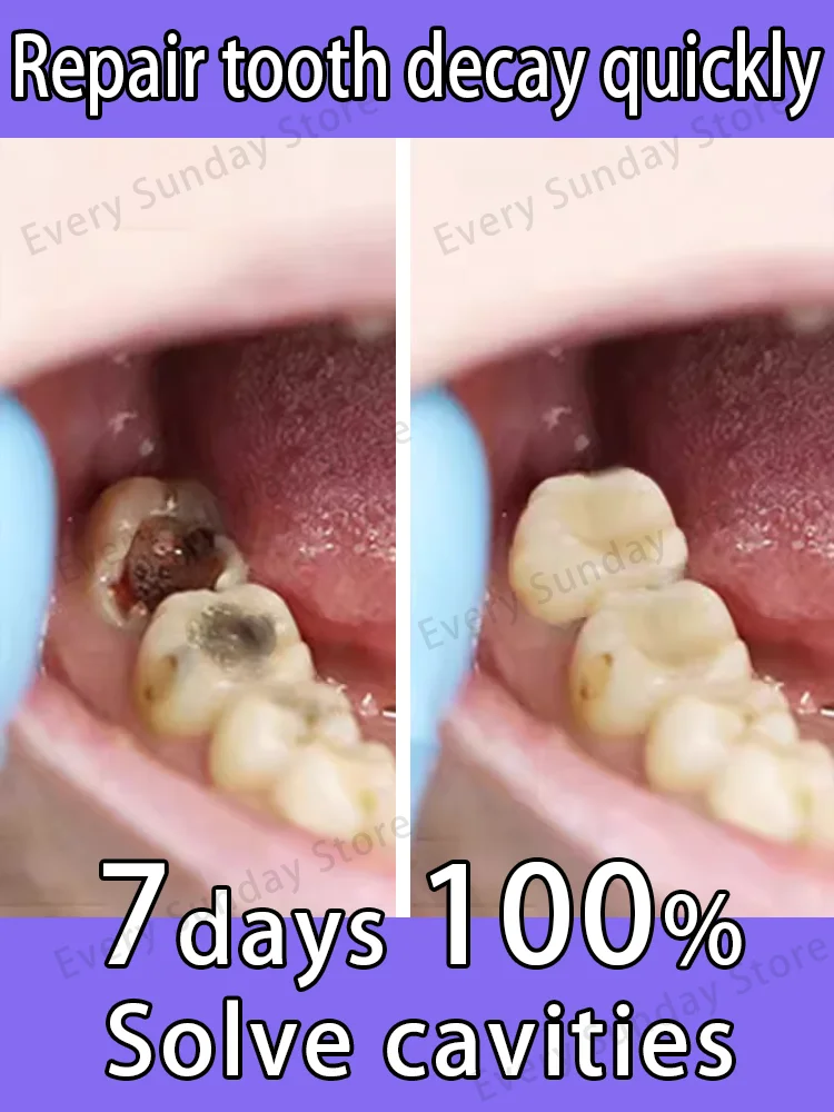 Clean cavities, whiten teeth, remove plaque, treat periodontitis ...