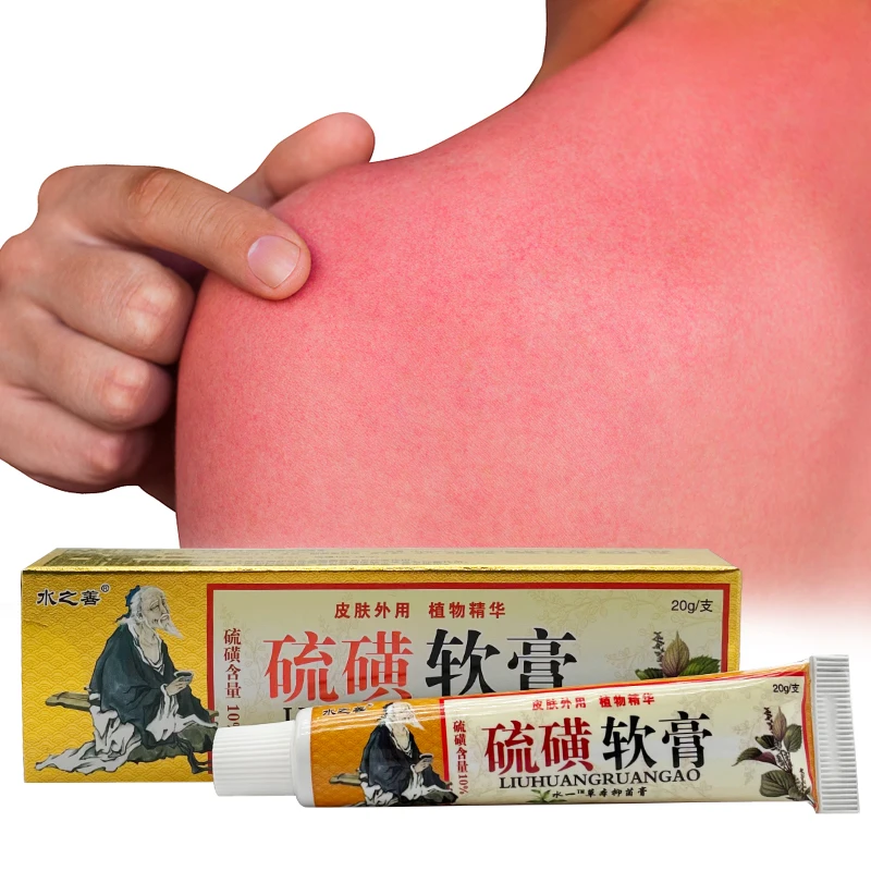 Hot-Selling-Sulfur-Psoriasis-Ointment-Chinese-Herbal-Cure-Psoriasis-Dermatitis-Eczema-Creams ...
