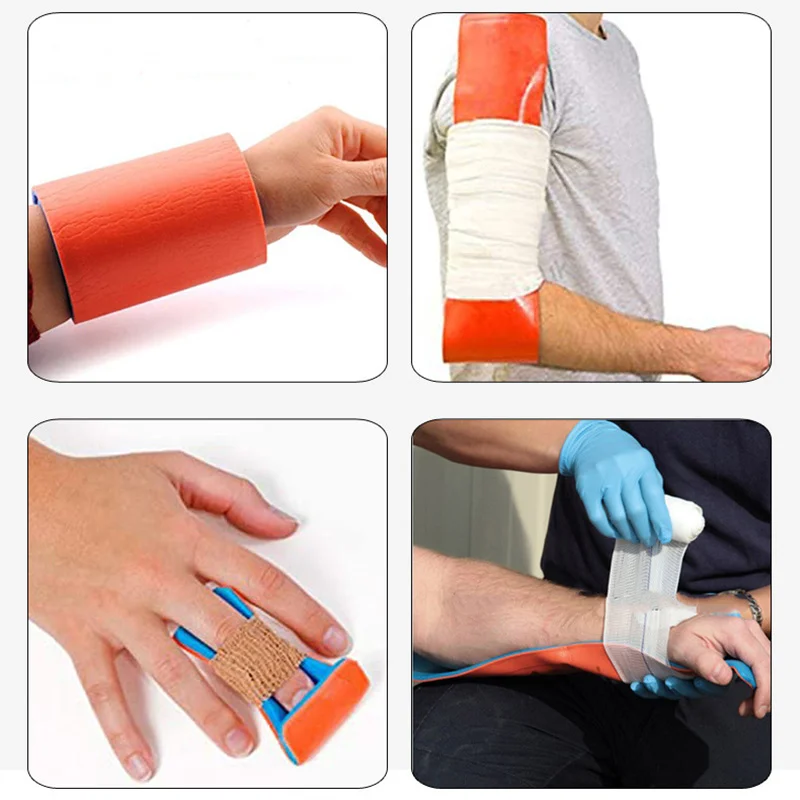 Hand Fracture First Aid