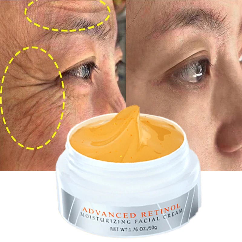 AUQUEST Retinol Wrinkle Face Cream Anti-Aging Collagen Hyaluronic Acid ...