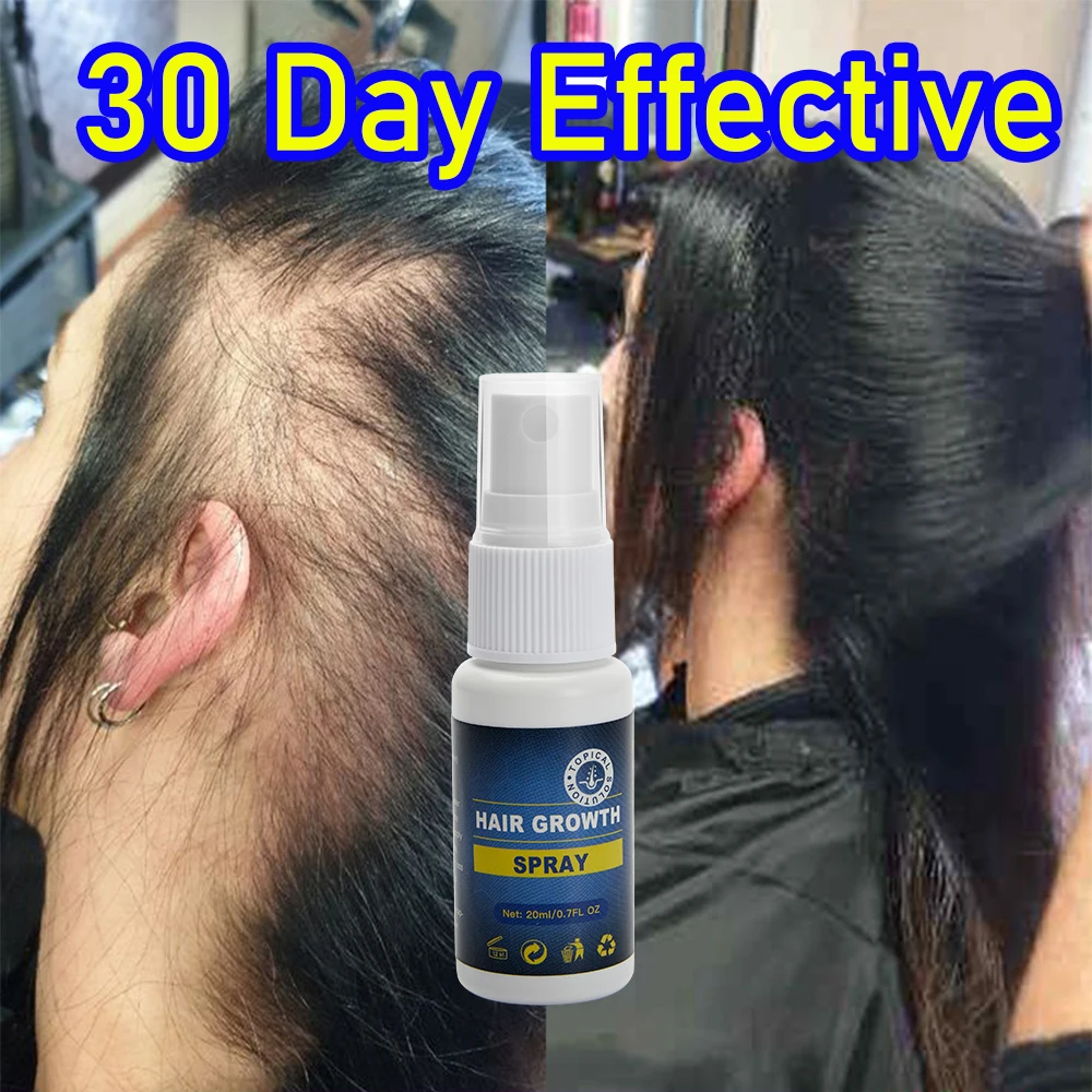 Hair-Growth-Products-Fast-Growing-Hair-Serum-Spray-Anti-Hair-Loss ...