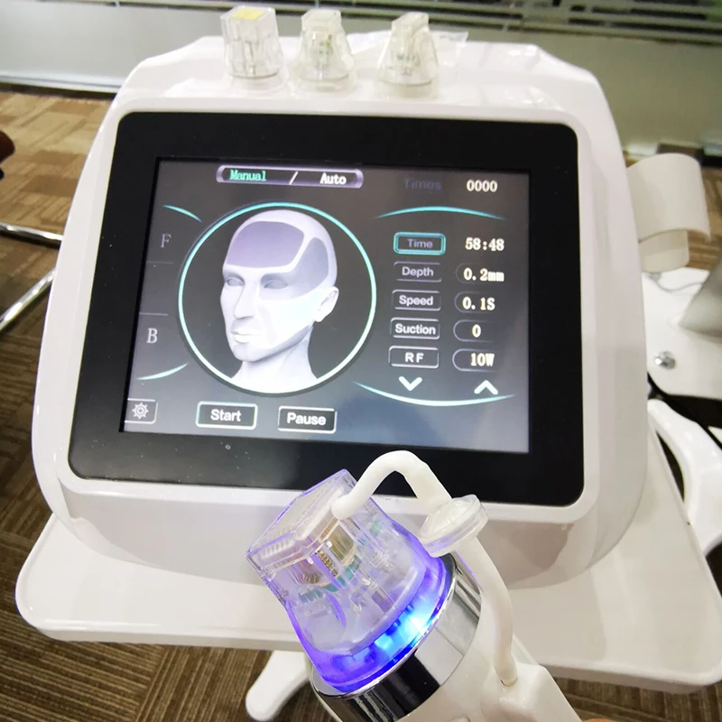 Microneedling Rf Machine Stretch Mark Removal Acne Treat Lifting ...