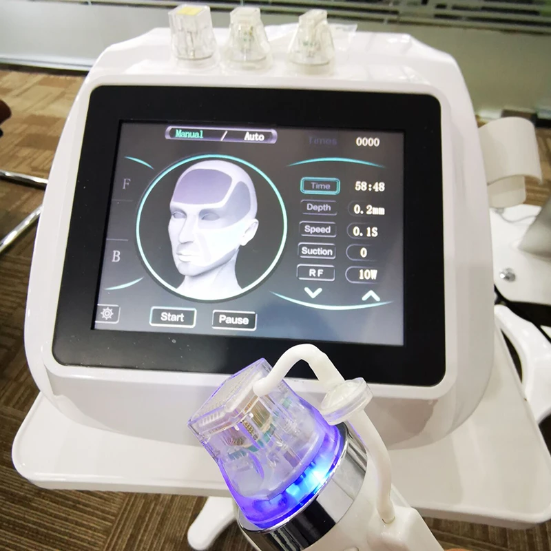 Microneedling Rf Machine Stretch Mark Removal Acne Treat Lifting ...