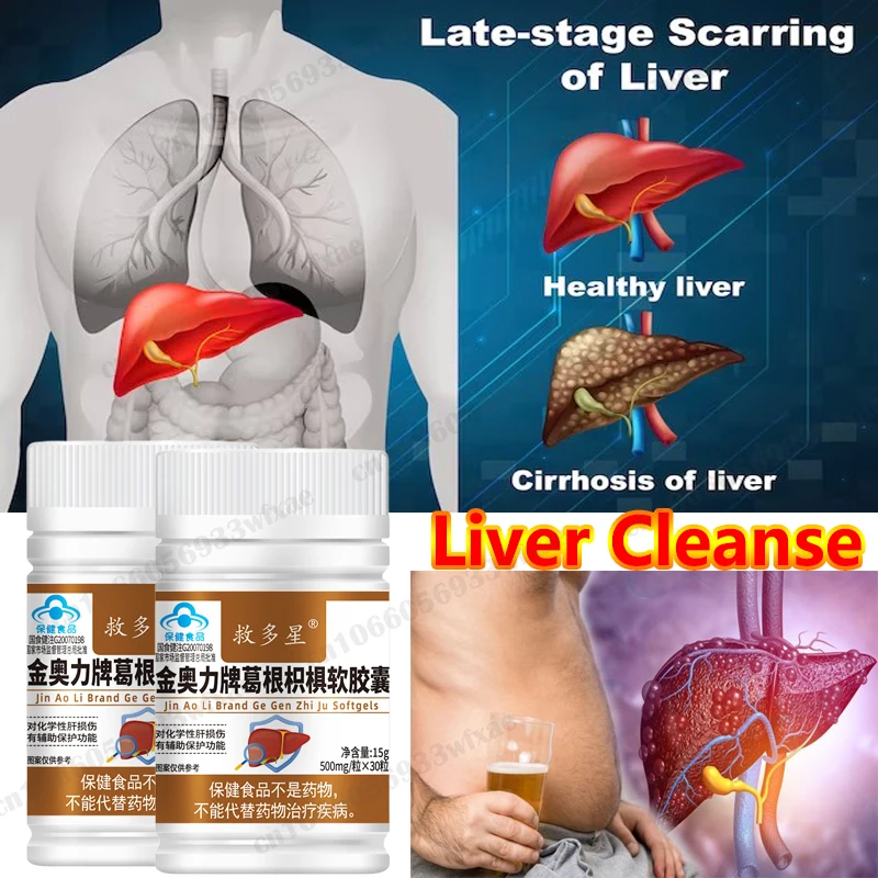 Liver-Detox-Cleanse-and-Support-Supplement-Herbal-Formula-Repairs ...