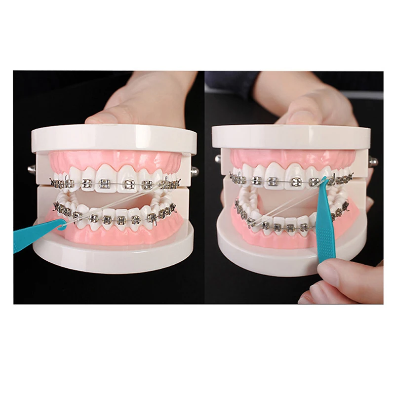 Orthodontic-Rubber-Band-Extractor-Disposable-Dental-Elastic-Placer-For ...