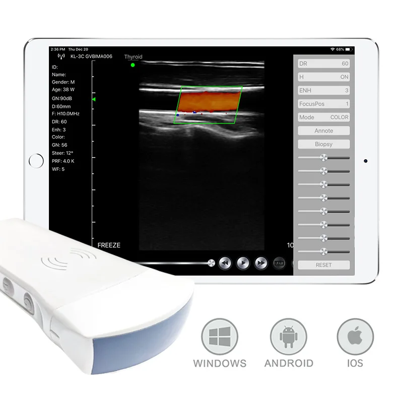 Wh-10-Wireless-Wifi-portable-ultrasound-For-Ob-gyn-Urology-Abdomen ...