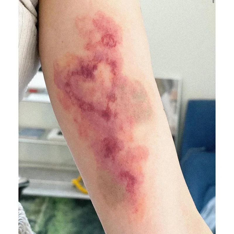 Heart Bruise Fake Tattoo for Woman Man Arm Art Scar Blood Stasis ...