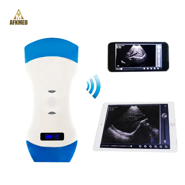 Portable-hand-held-Wireless-ultrasound-probe-colour-doppler-ultrasonic ...