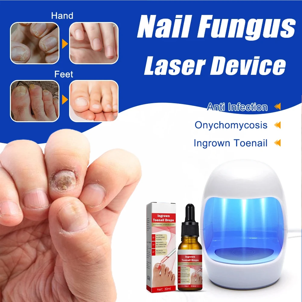 Nail-Fungus-Laser-Treatment-Device-Fungal-Treatment-Feet-Care-Essence ...