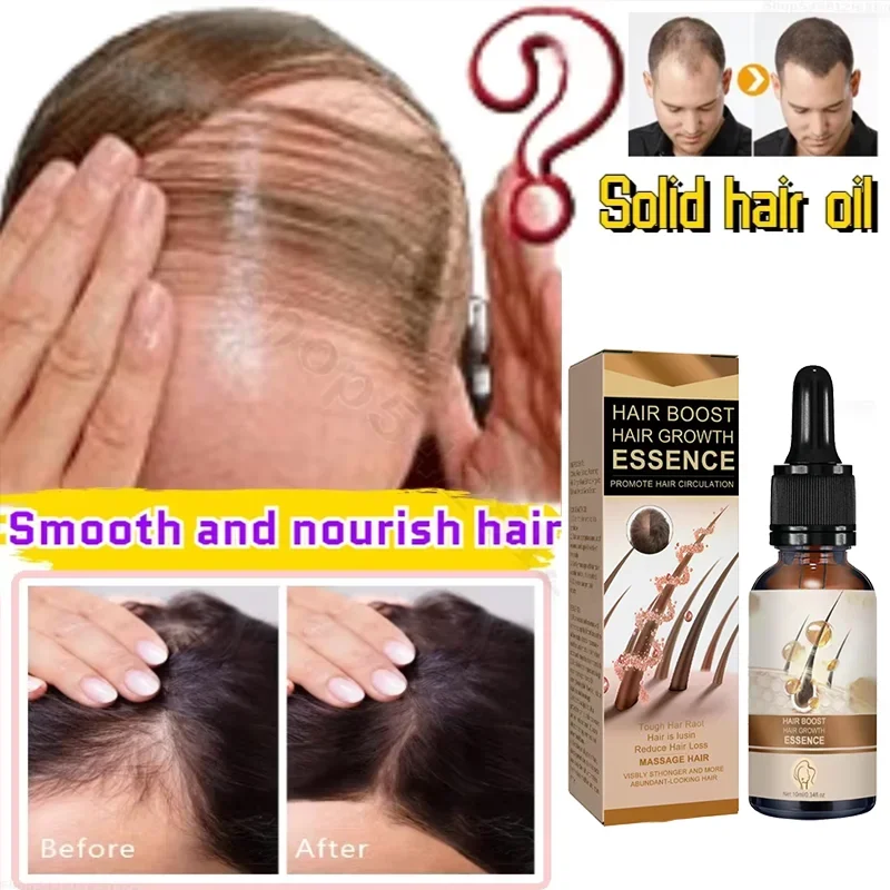 Fast-Hair-Growth-Serum-Beard-Oil-Axillary-and-Chest-aHair-Regrowth ...