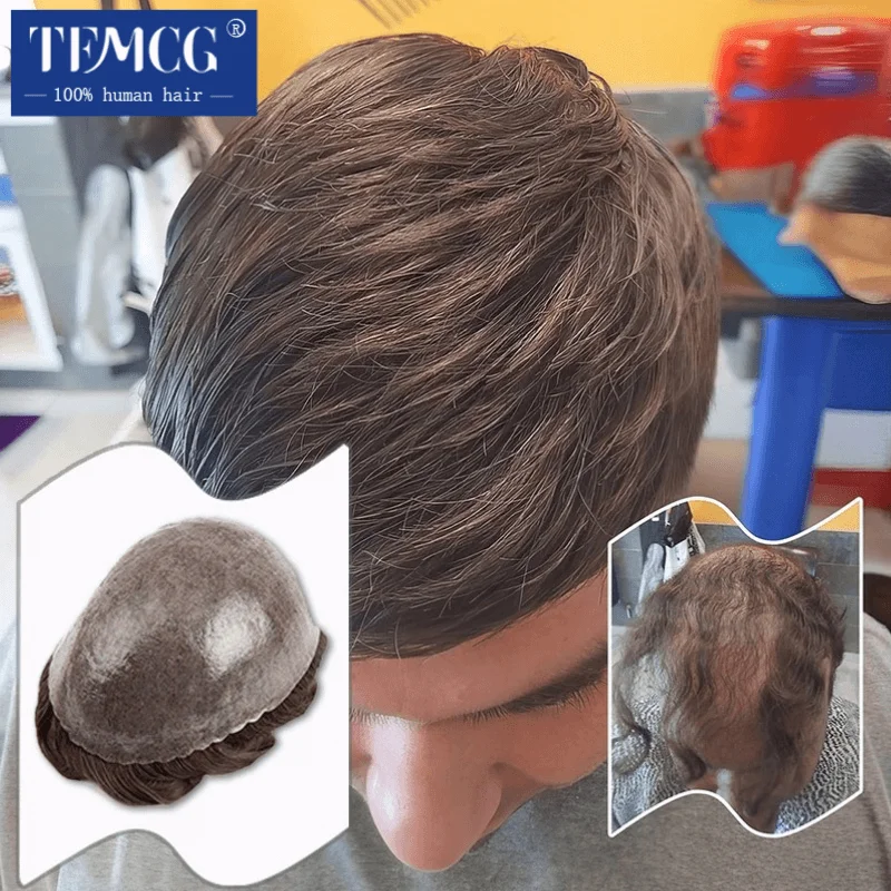 Male-Hair-Prosthesis-0-12mm-Full-Skin-Man-Wig-More-Durable-Toupee-Men ...