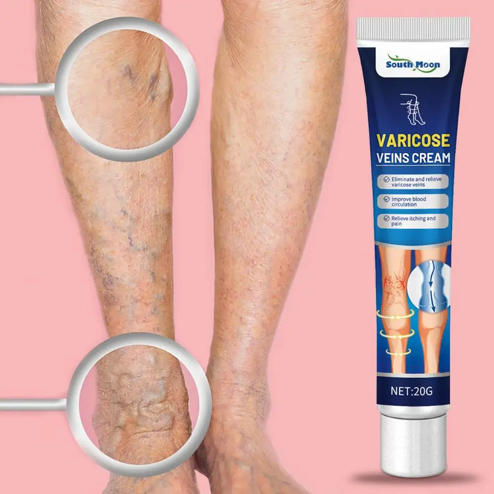 20g-Crème Contre Varices Et Varices, Baume Apaisant Pour Les Jambes ...