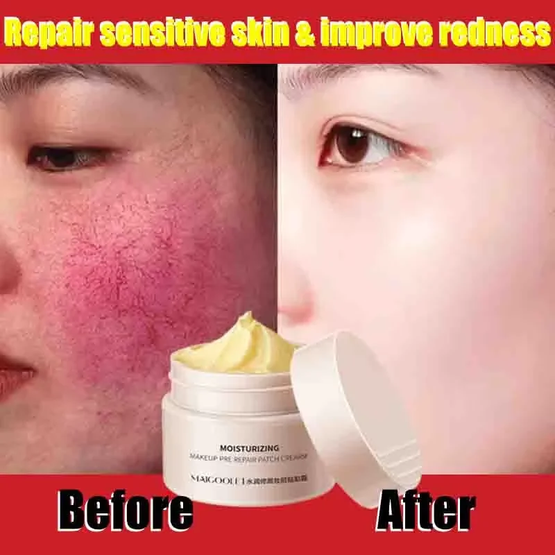 Facial Redness Repair Cream Improve Sensitive Skin Dryness Moisturizer ...