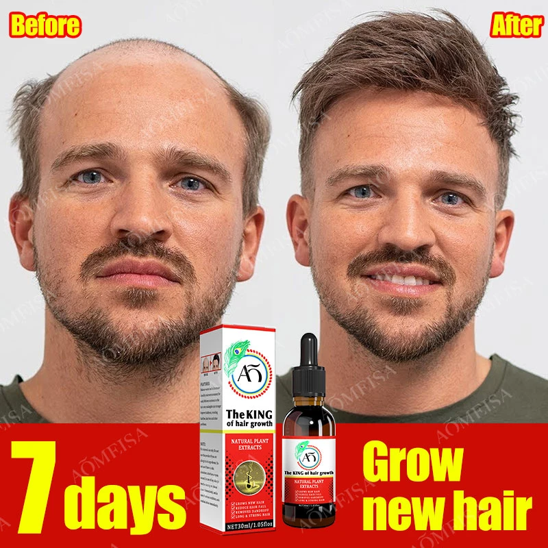 Powerful hair growth Anti hair loss Anti baldness Fast hair growth Hair ...