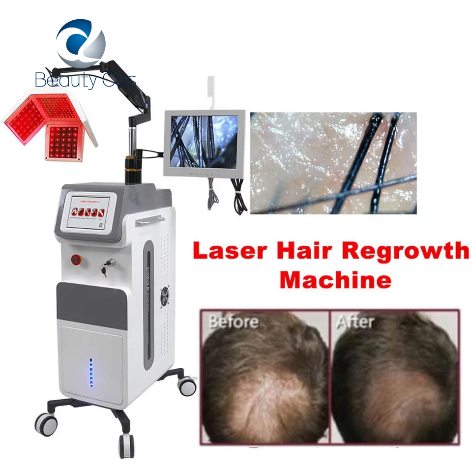 Professional Laser Hair Growth Machine Hair Regrowth Treatment Scalp ...