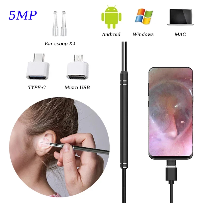 Visual Ear Scoop Endoszkópos Kamera Otoscope 6Led Ip67 Endoszkóp 5Mp ...