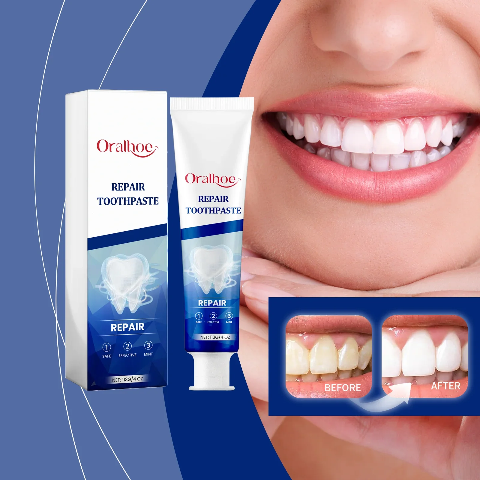 Xylitol Mint Teeth Repair Toothpaste Repair Protect Teeth Remove Plaque ...