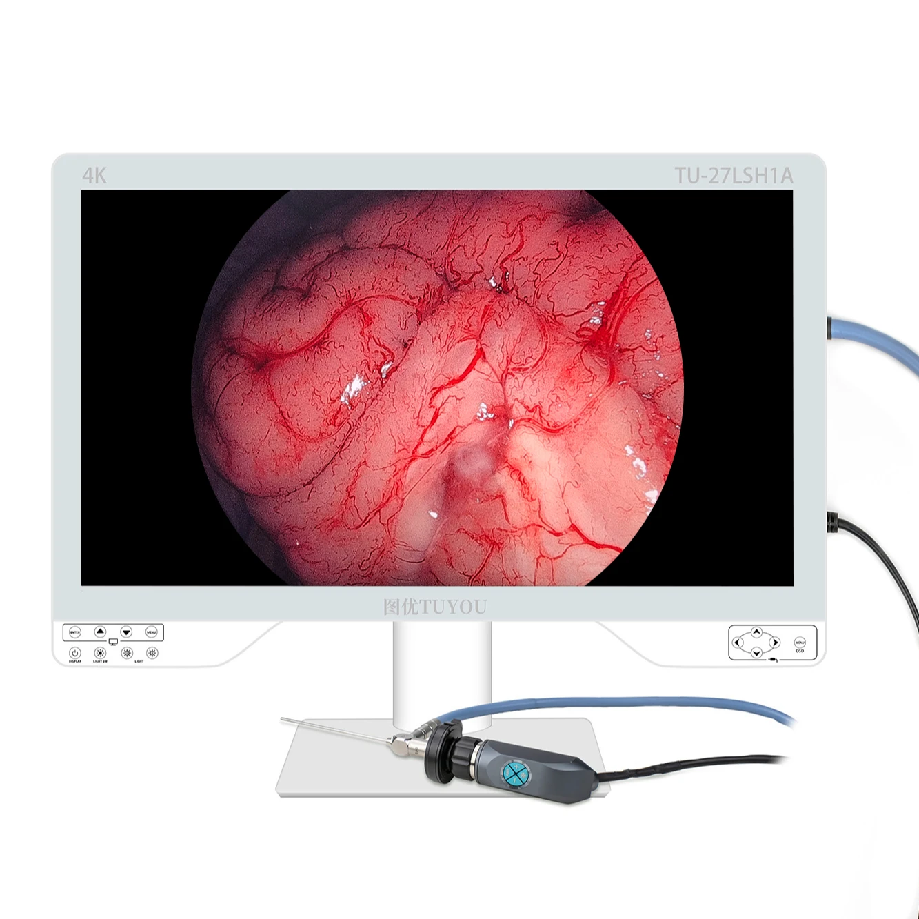 Tuyou-Medical-4K-Full-ENT-Laparoscopic-Diagnostic-Endoscopic-With-27 ...