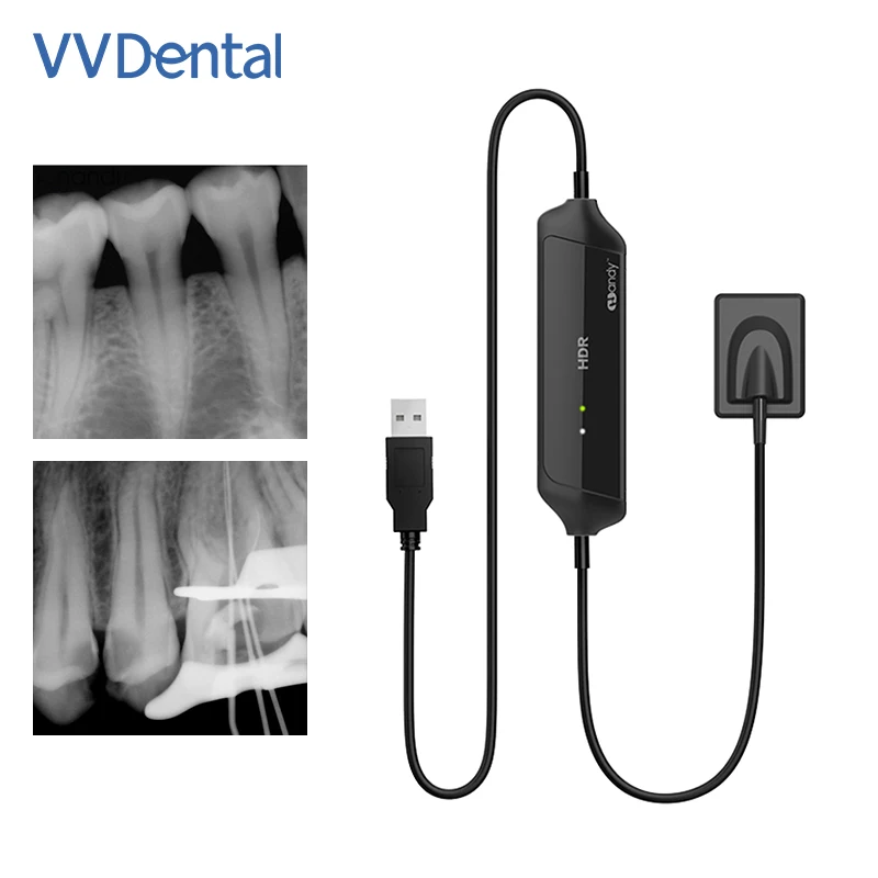 VV-Dental-Sensor-X-Ray-Radiovisiograph-High-Frequency-Digital-Intraoral ...